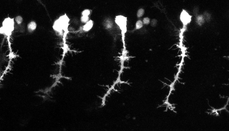 An engineering approach to shape neuronal connections | HSCRB