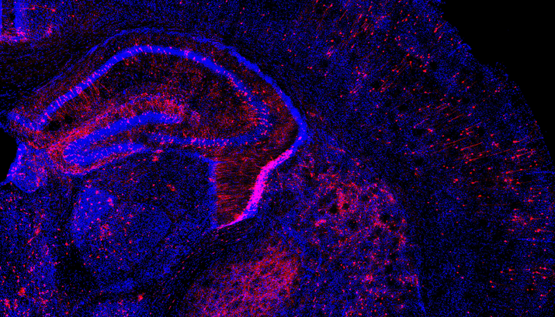 A large-scale tool to investigate the function of autism spectrum ...